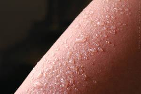 Queimadura de Sol: o que fazer? - Planos de Saúde em Sorocaba